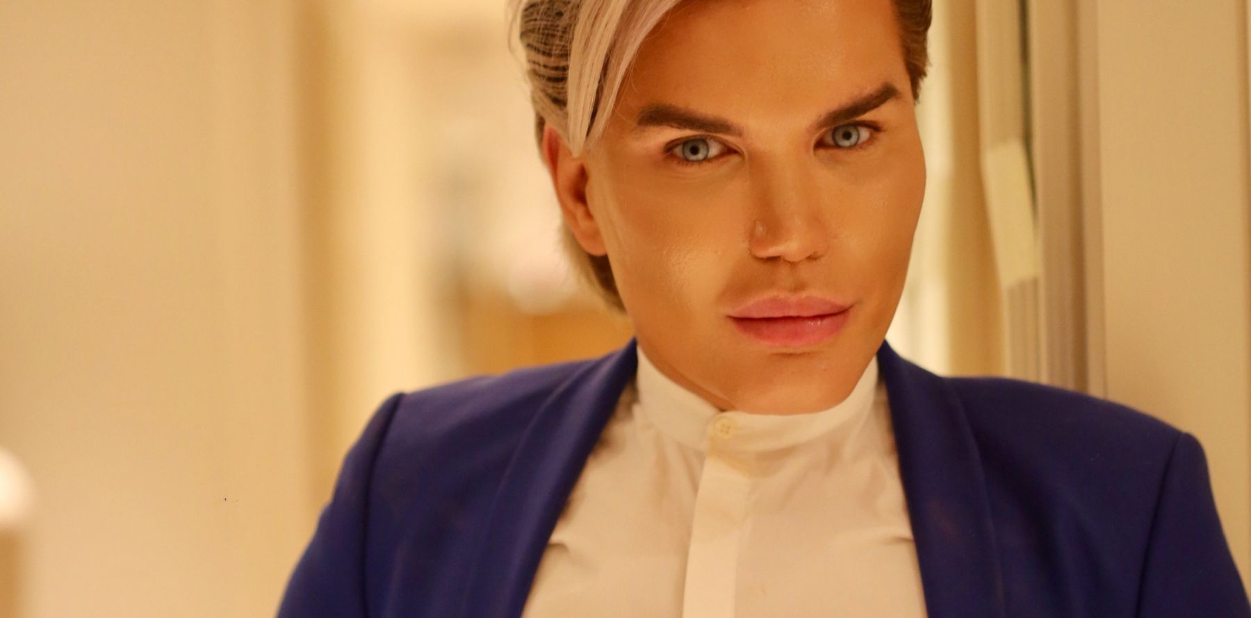 Rodrigo Alves : Le Ken humain vise une nouvelle opération de l'extrême ...