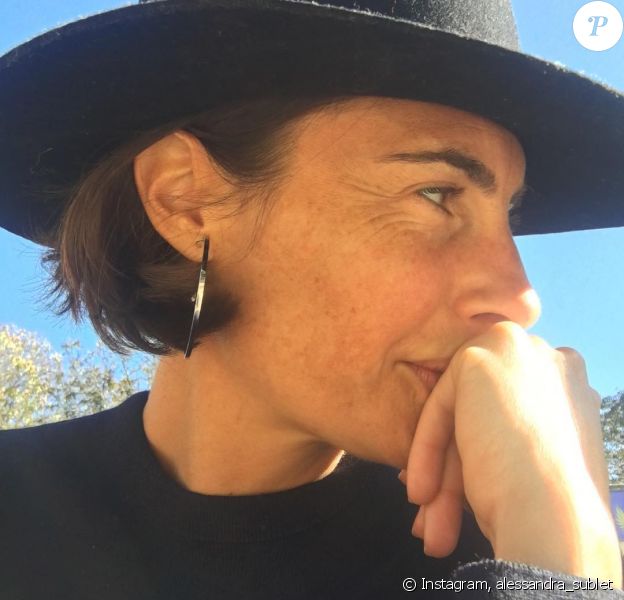 Alessandra Sublet : Avant/après bluffant de son "lifting" - Purepeople