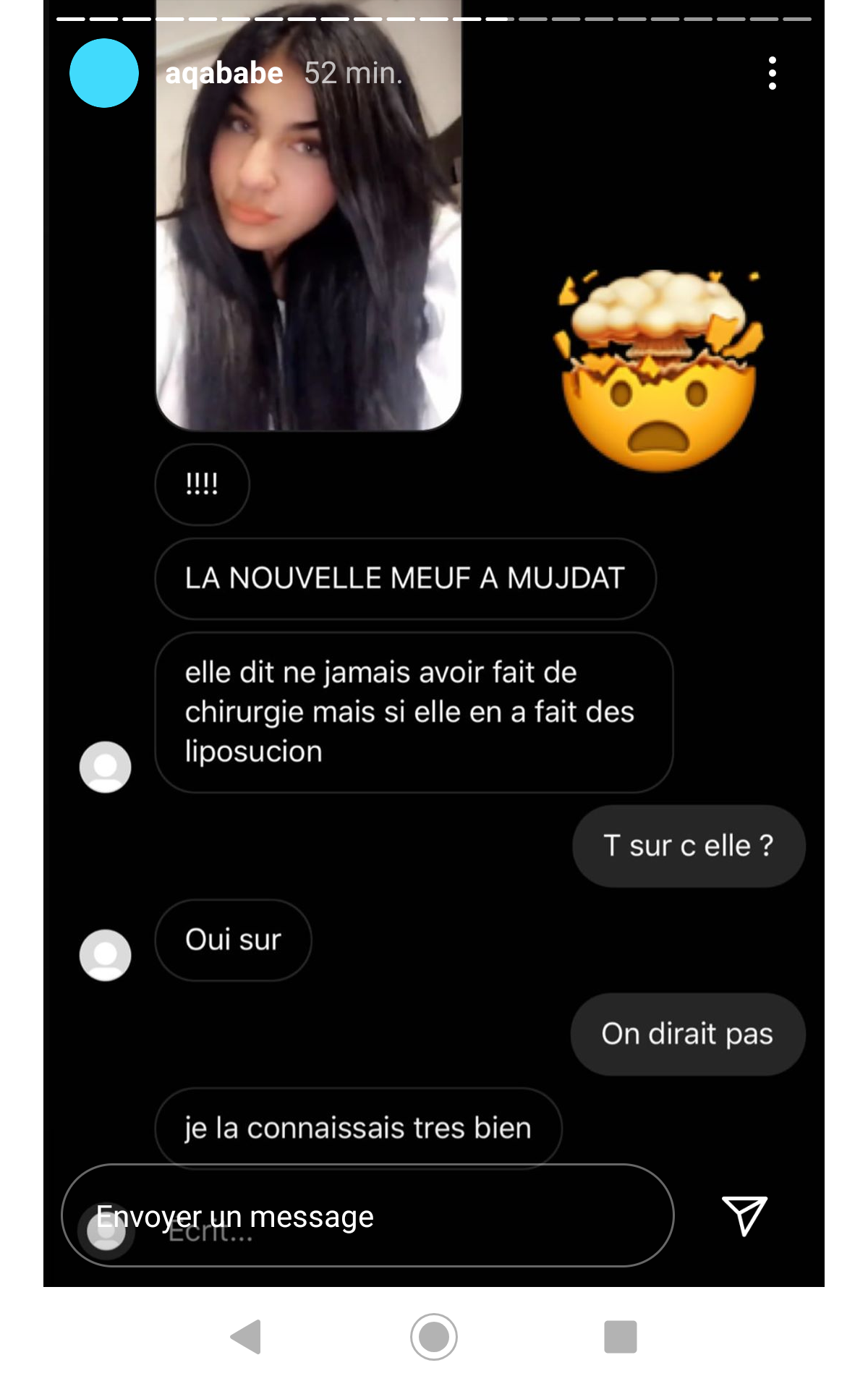 Photo : Des photos de Feliccia, la compagne de Mujdat, avant chirurgie ...