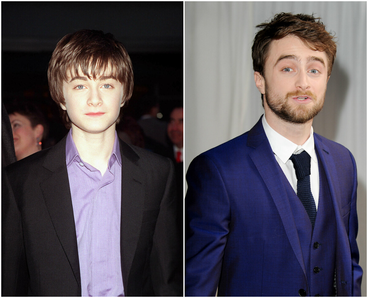 Photo : Daniel Radcliffe à New York en 2001 / Daniel Radcliffe en 2015 ...