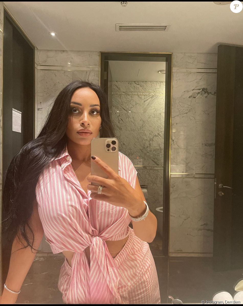 Demdem brûlée, la femme de Gims dévoile son corps amoché : "On m'a tué ...