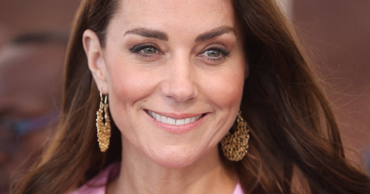 Kate Middleton : Cette "grande cicatrice" dont elle refuse de dévoiler ...