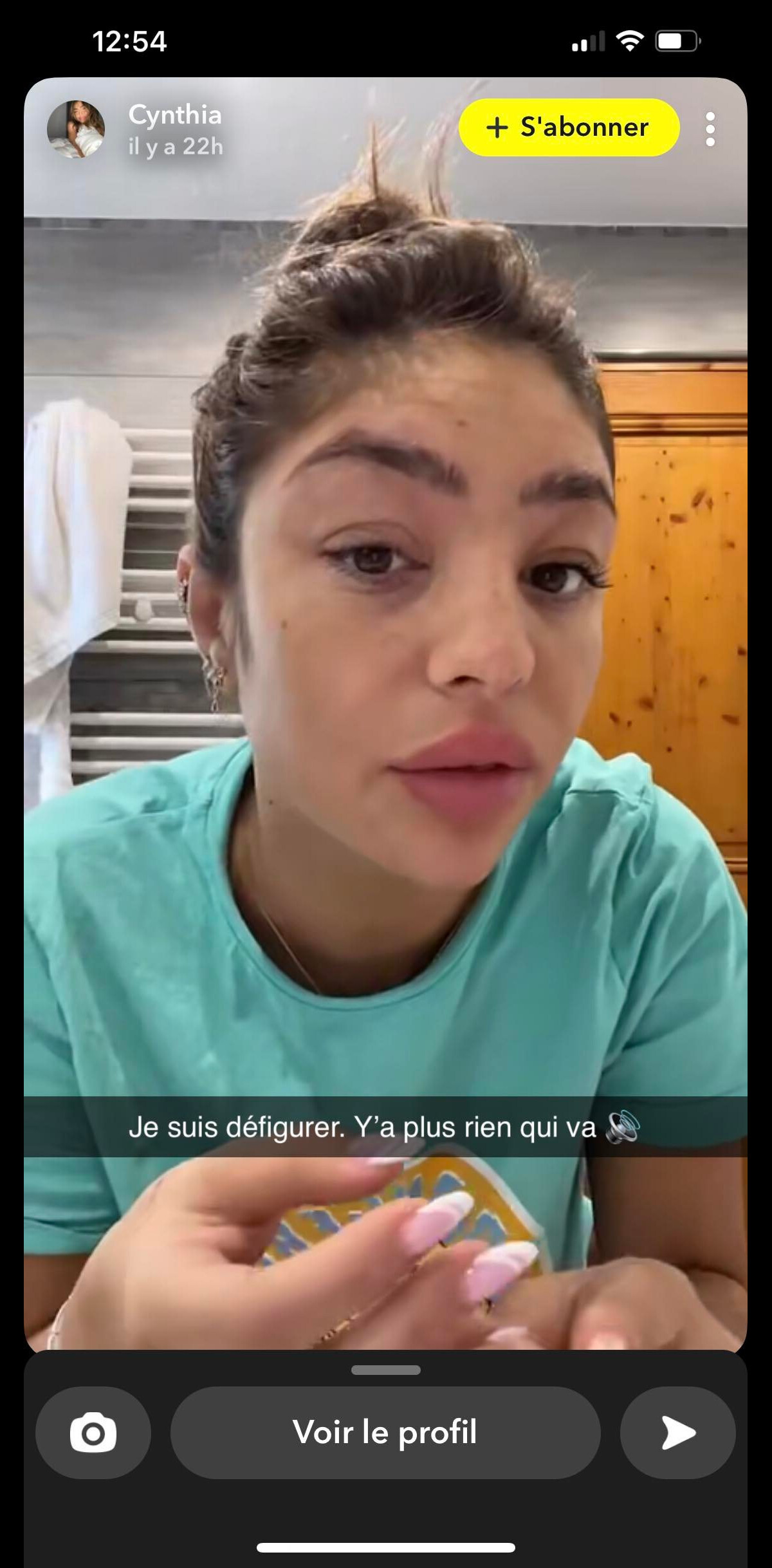 Photo Ses Paupières Ont Triplé De Volume Carla Moreau Trompée Par