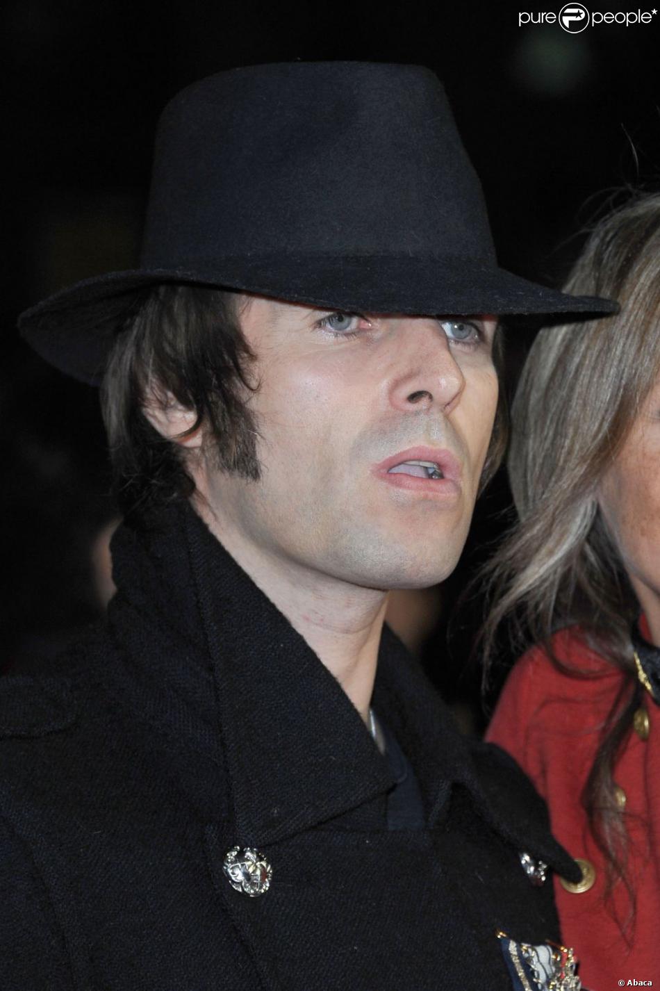 Liam Gallagher : Le bad boy à l'hôpital à cause d'un... M&M's ...