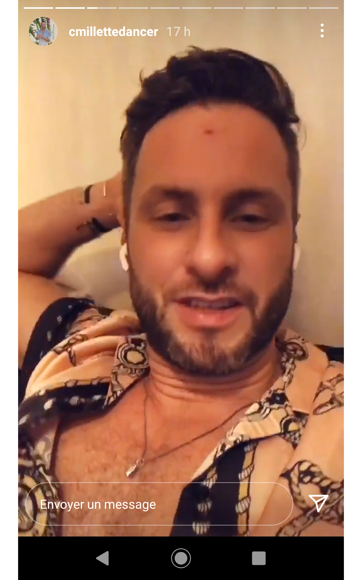 Photo : Christian Millette dévoile qu'il s'est blessé au front, le 26 ...