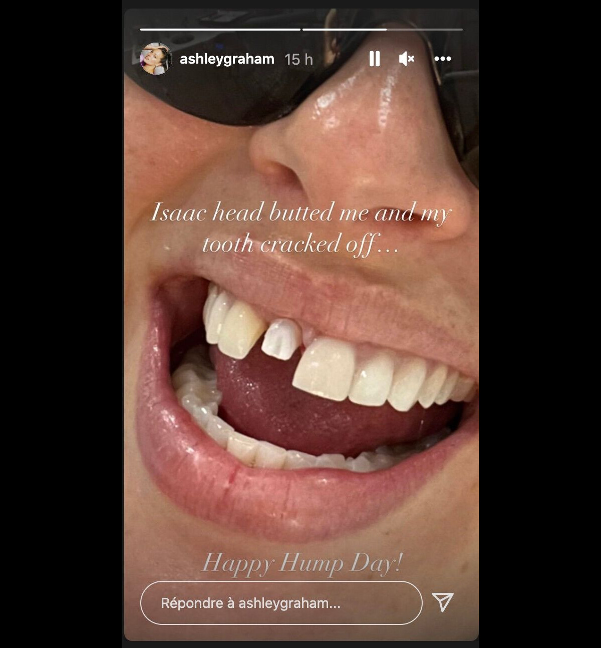 Photo : La mannequin Ashley Graham dévoile sa dent, après que son fils ...