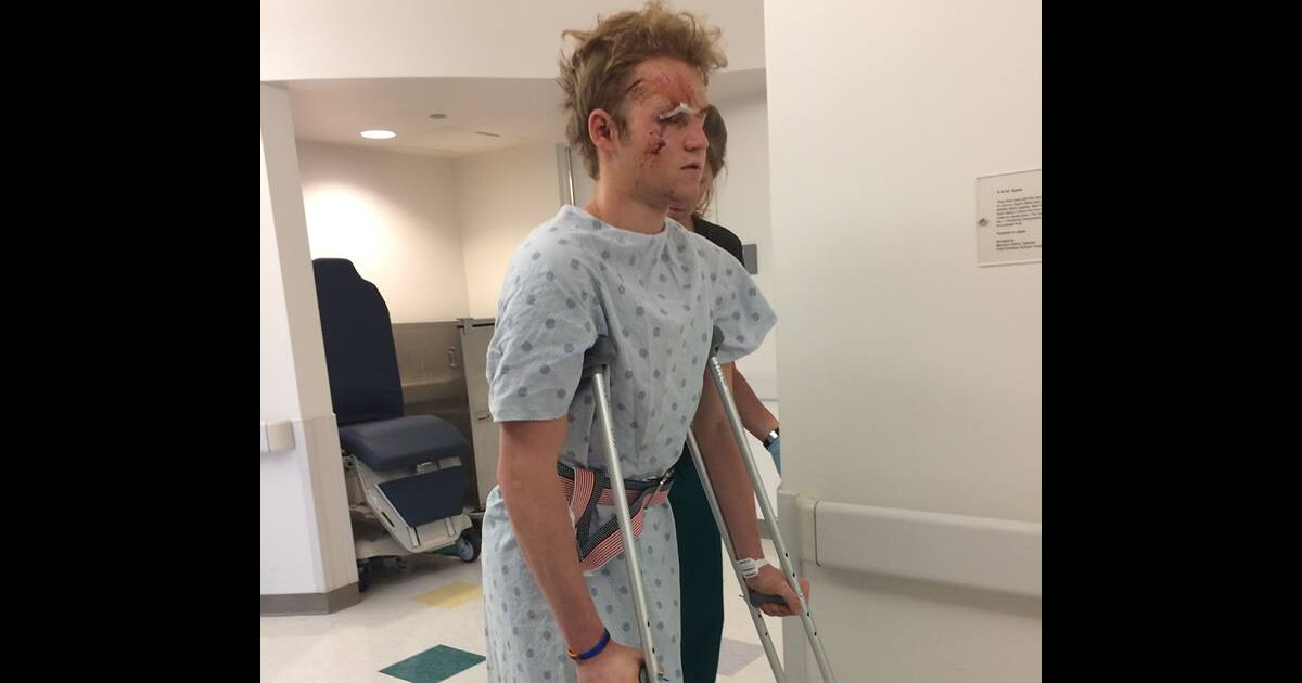 Dalton Gray (American Horror Story) : Hospitalisé après un grave ...