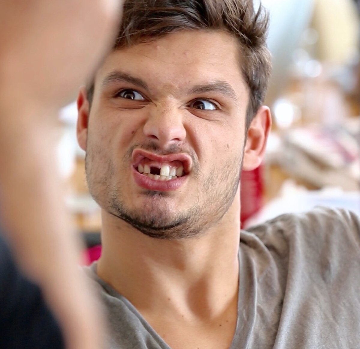 Photo : Florent Manaudou avec une dent en moins façon Very Bad Trip ...