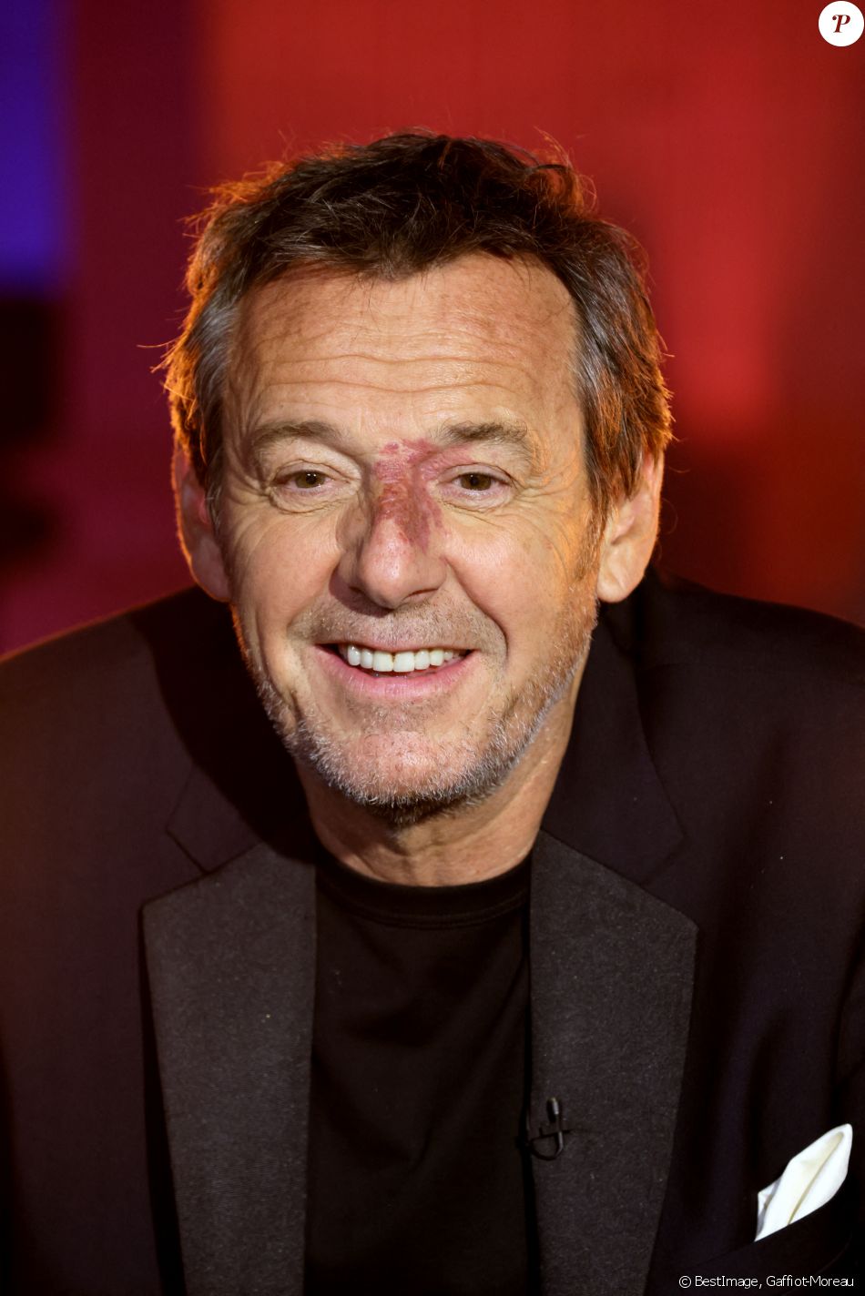 Jean-Luc Reichmann : D'où vient sa tache sur le nez ? : le diaporama ...