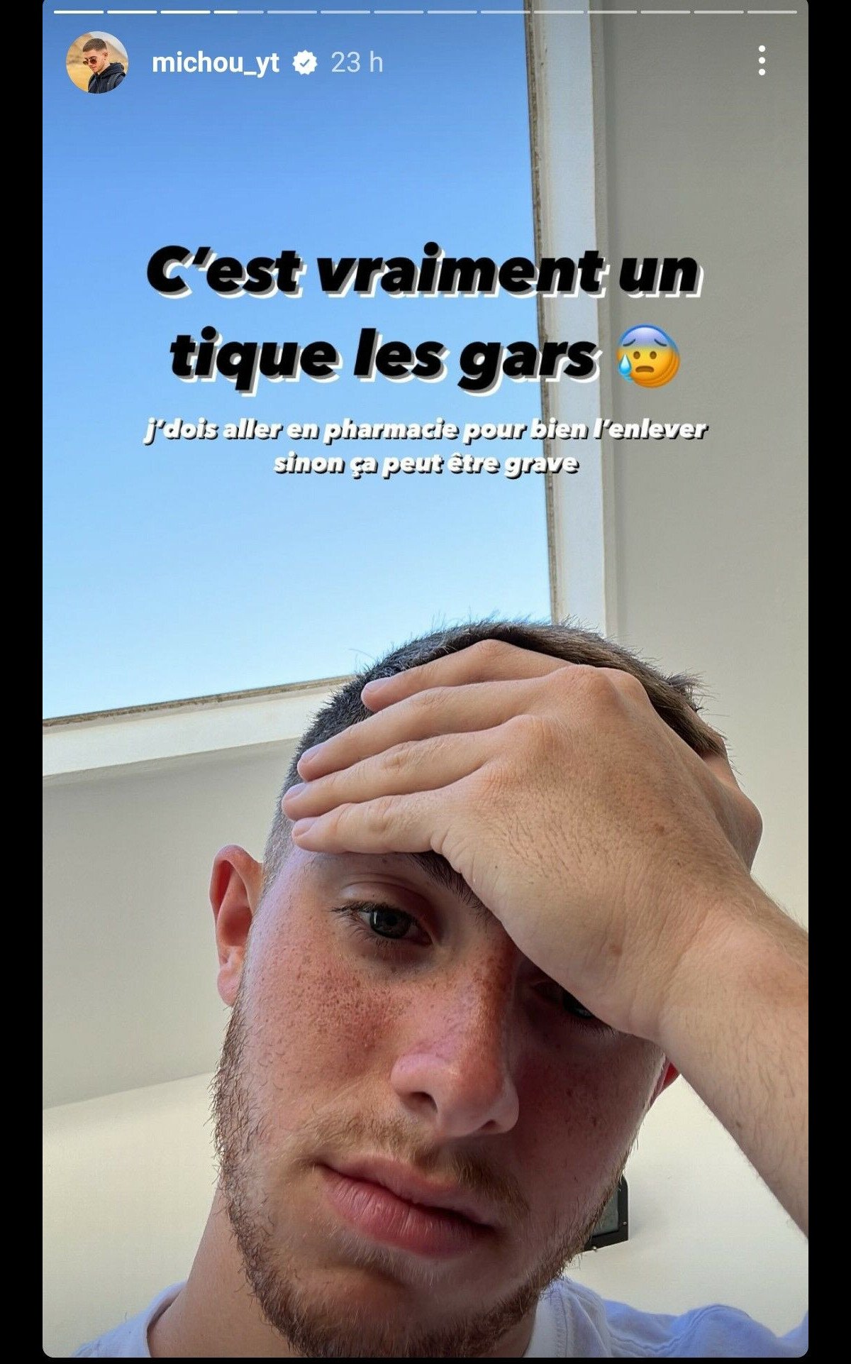 Photo : Michou sur Instagram. - Purepeople