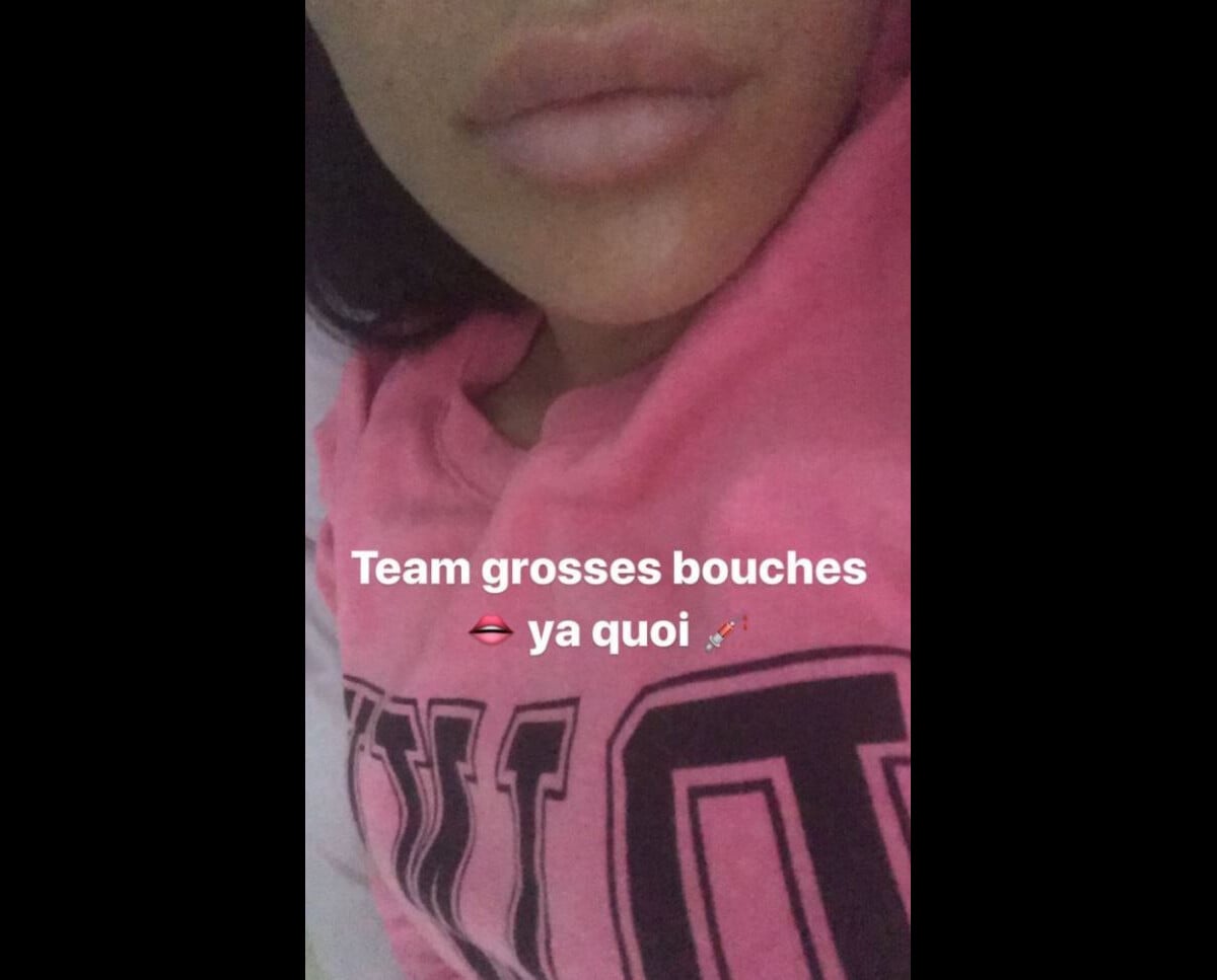 Photo : Milla Jasmine fière de sa nouvelle bouche pulpeuse. - Purepeople