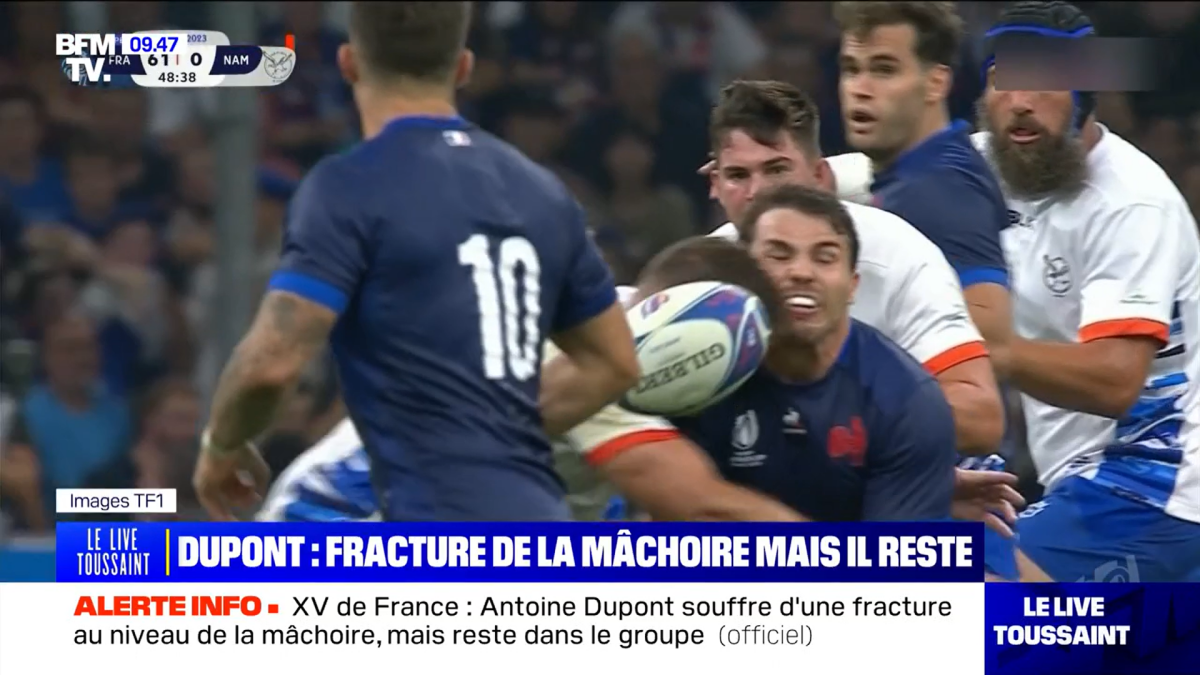 Photo : Images chocs et nouvelles d'Antoine Dupont après sa blessure contre la Namibie, "BFMTV ...