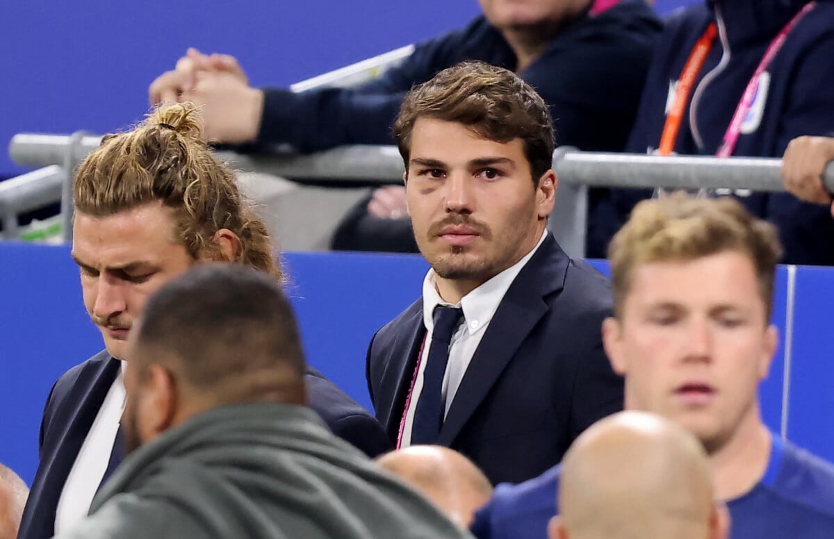 Photo : Il a été opéré à la pommette Antoine Dupont à l'issue du match ...