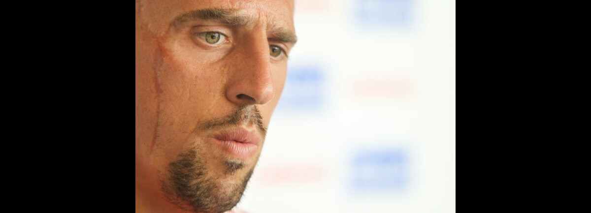 Photo : Franck Ribéry le 7 juillet 2011 à Arco en Italie - Purepeople