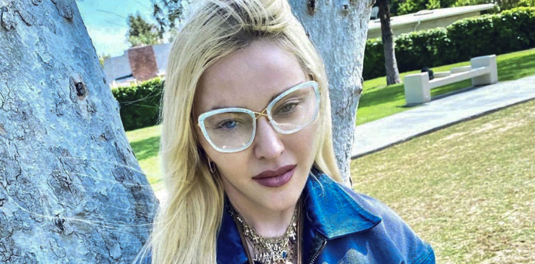 Madonna : Lifting, injections, rhinoplastie... des chirurgiens ...
