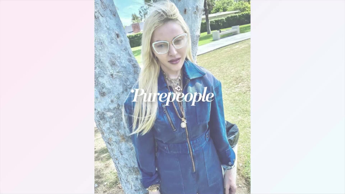 Vidéo : Madonna : Lifting, injections, rhinoplastie... des chirurgiens ...
