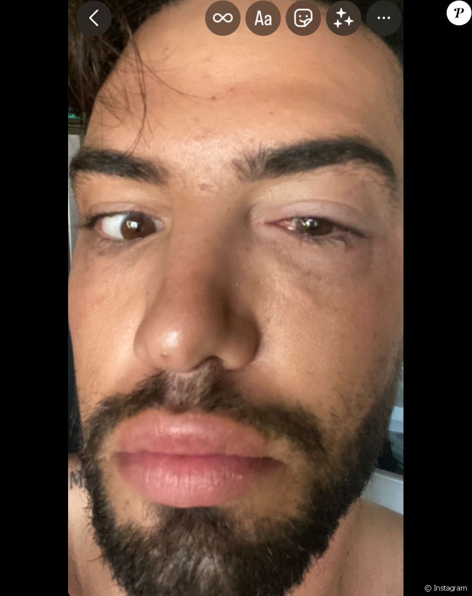 Secret Story : Un ex-candidat victime de violences conjugales ...