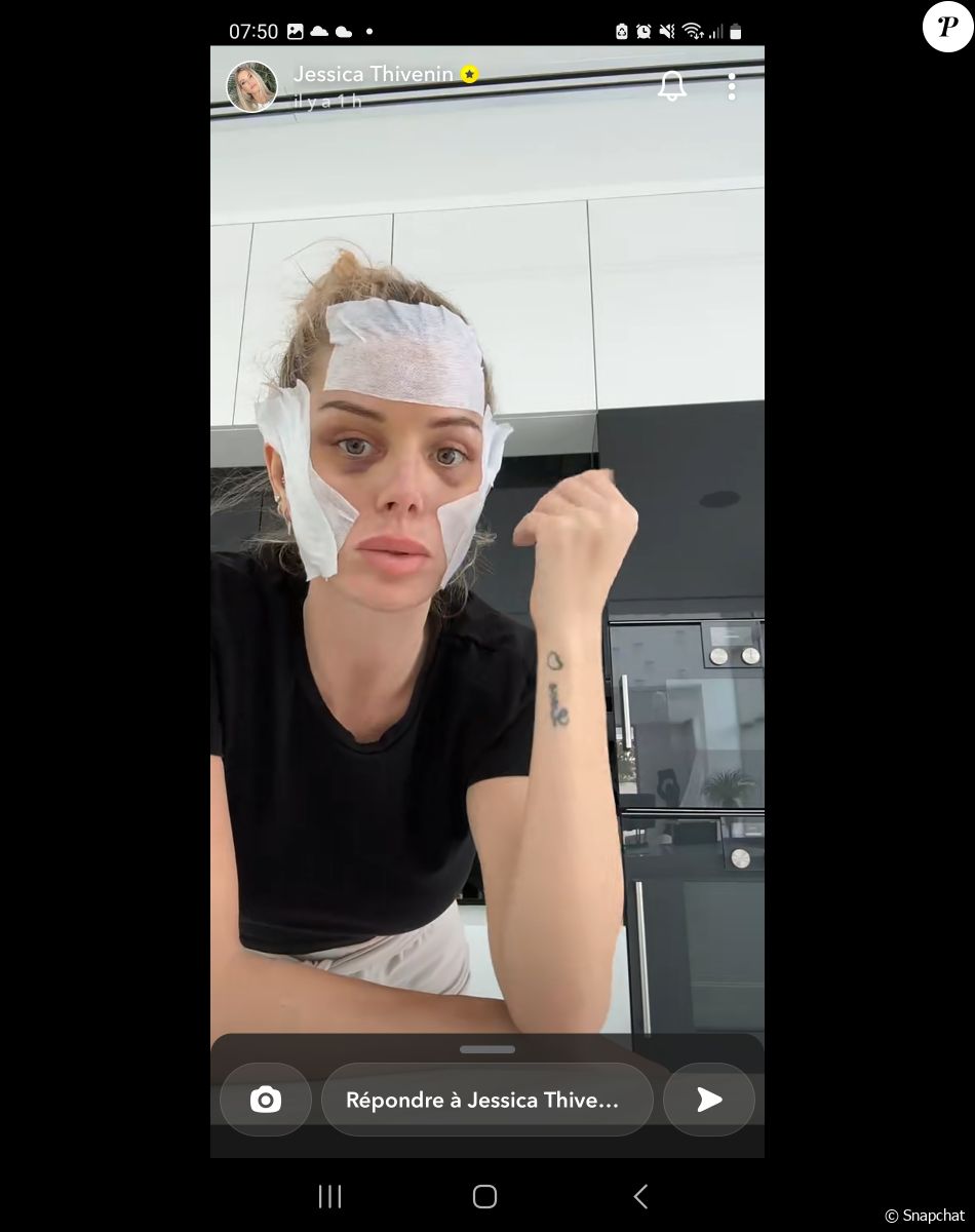 Jessica Thivenin méconnaissable après son opération : elle dévoile sa ...