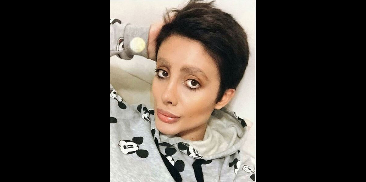 Photo : Sahar Tabar, avant ses opérations de chirurgie esthétique ...