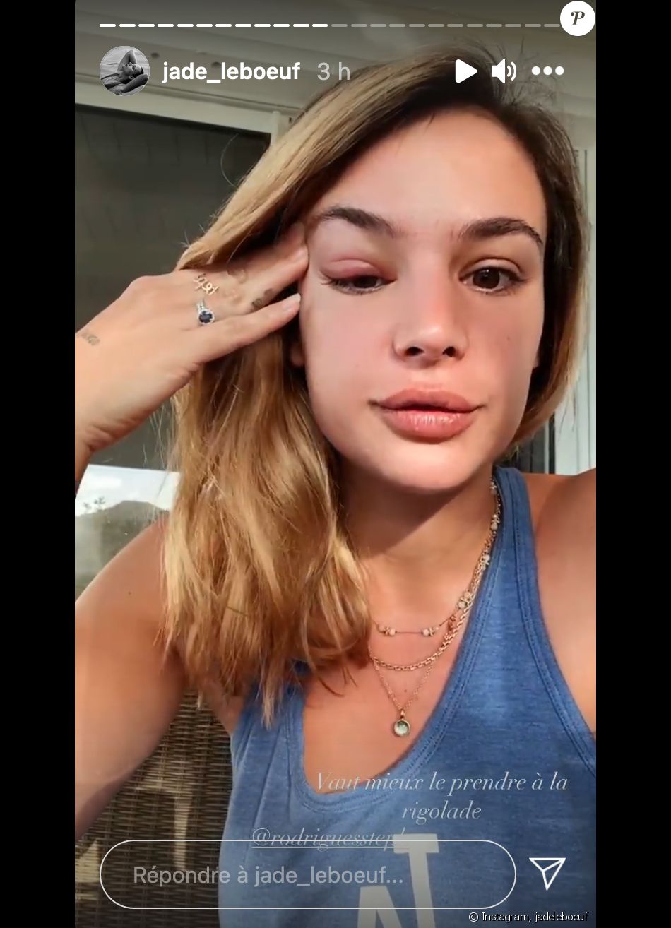 Jade Leboeuf : Défigurée et moquée par son mari Stéphane : le diaporama ...