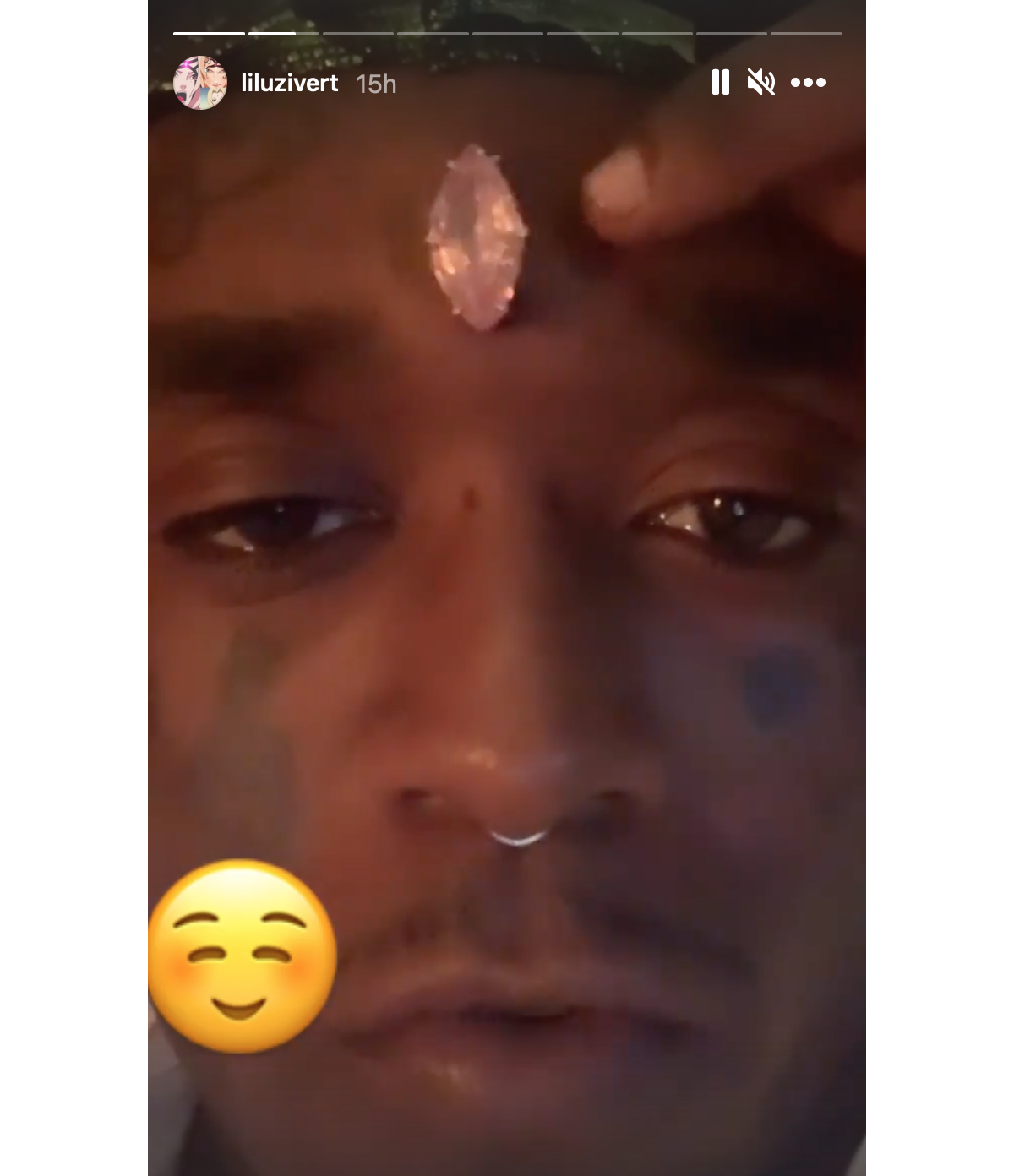 Photo : Lil Uzi Vert s'est fait poser un diamant rose d'une valeur de ...