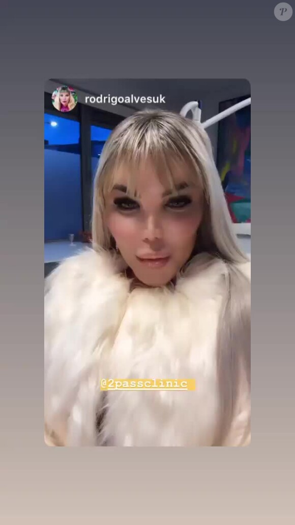 Vidéo : Roddy Alves dévoile son nouveau visage à 30 000€ sur Instagam ...