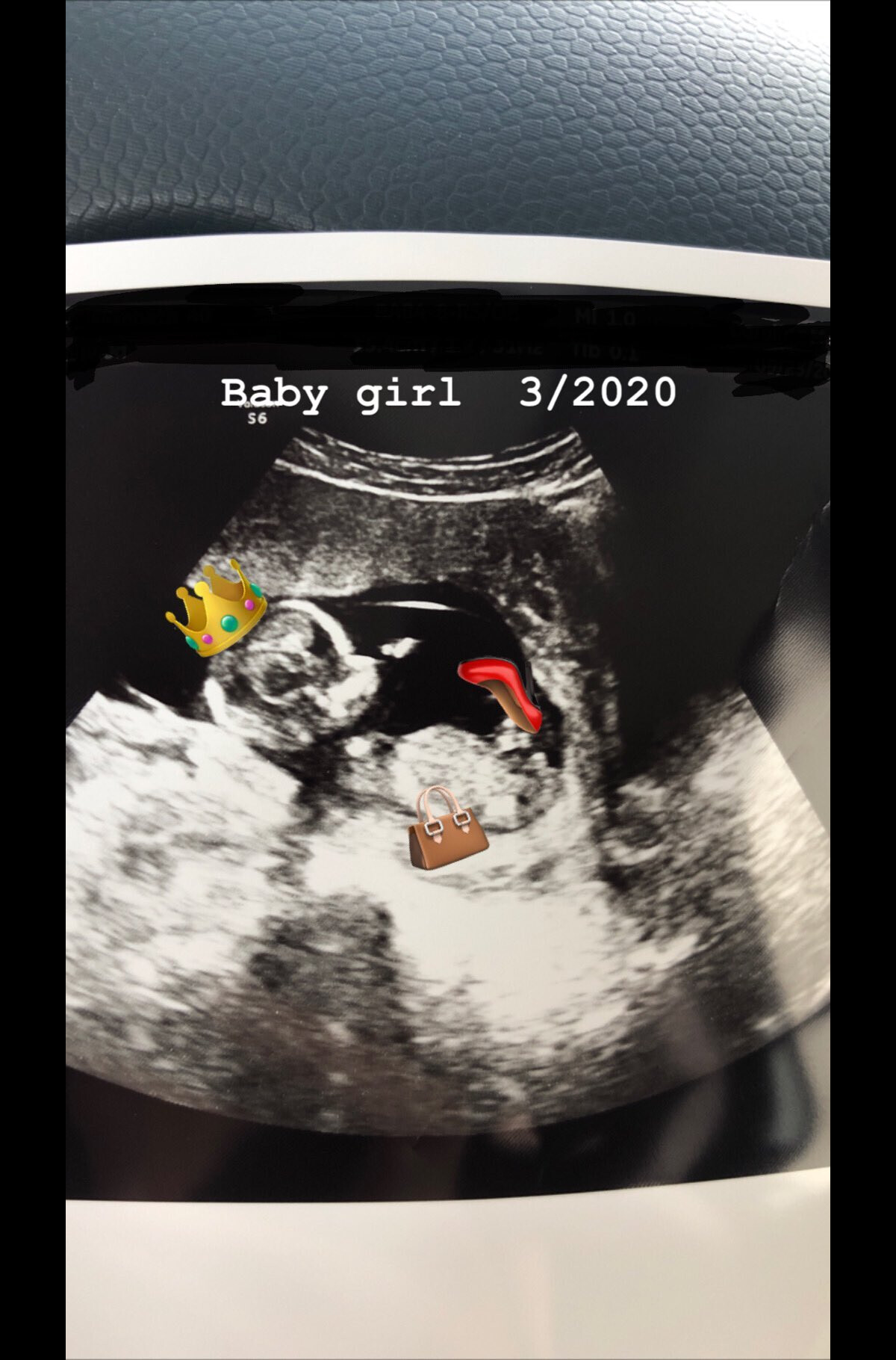 Photo : Elizabeth Hendrickson, célèbre Chloe Mitchell dans "Les Feux de ...