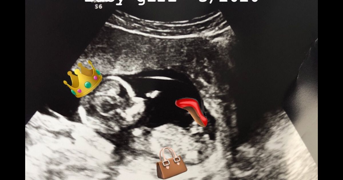 Elizabeth Hendrickson, célèbre Chloe Mitchell dans Les Feux de l'amour ...