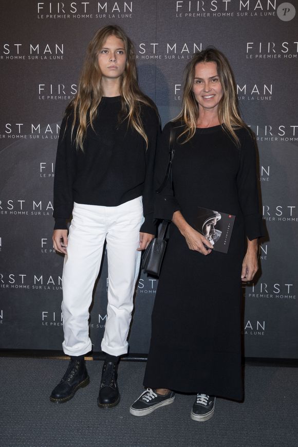 Emmanuel Petit : Sa fille mannequin, qui a coupé les ponts avec lui ...