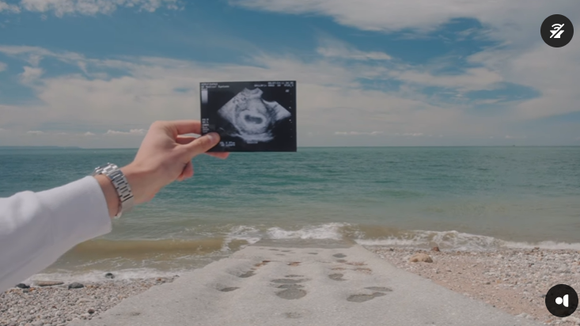 Photo : Il célèbre son mariage avec sa compagne Adèle. Thomas, ex ...