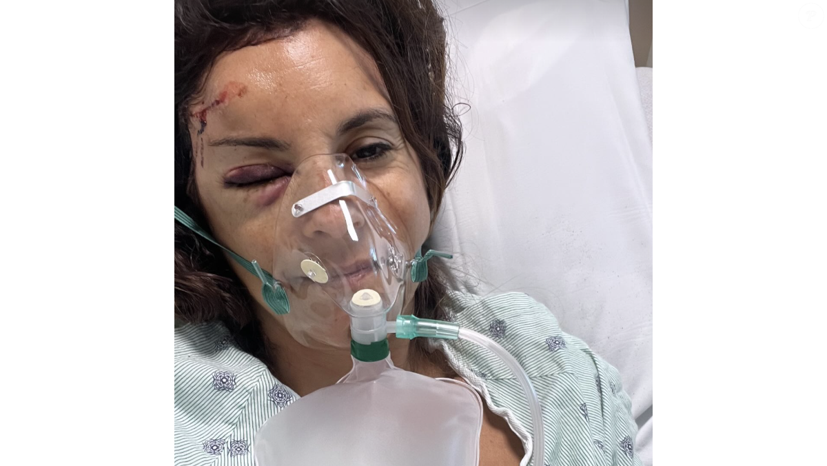 Vidéo : Hospitalisée et le visage défiguré, une ex-animatrice et femme d'un grand champion s ...